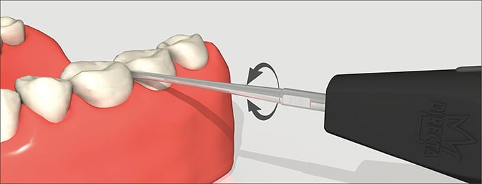 Luxator® Forte Elevator - Marletta Enterprises